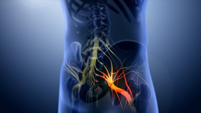 Sciatica Facts – Stop Sciatica Nerve Pain with Easy Natural Treatments